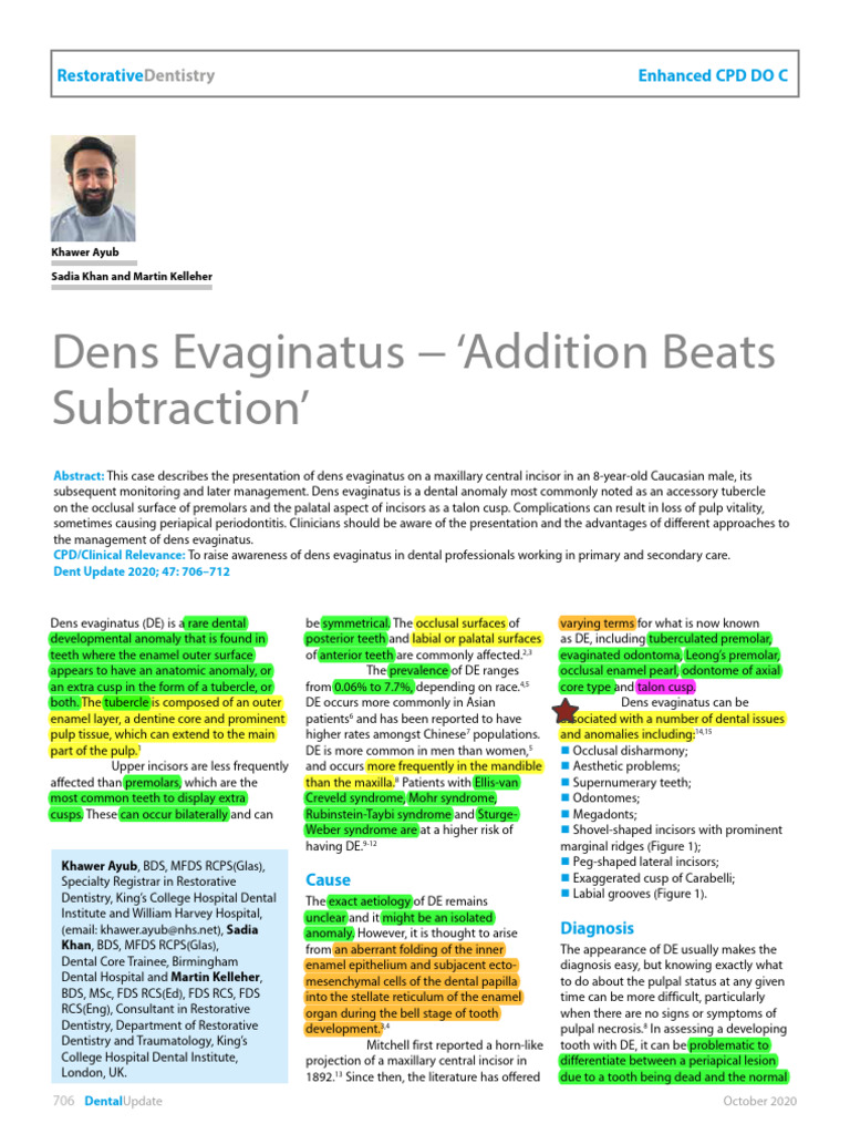 Dens Evaginatus | PDF | Human Tooth | Dental Anatomy