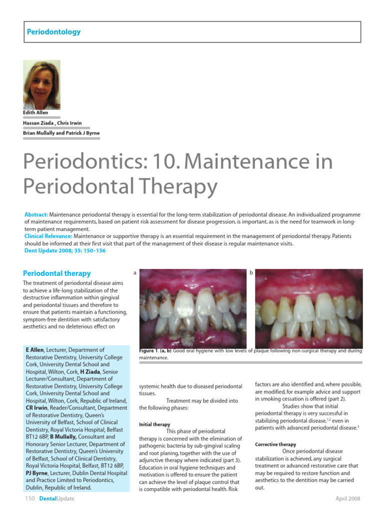 Periodontics: 10. Maintenance in Periodontal Therapy: Periodontology ...