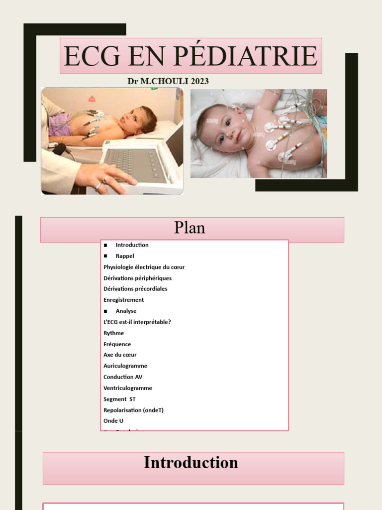 ECG en Pédiatrie | PDF | Électrocardiographie | Cardiologie
