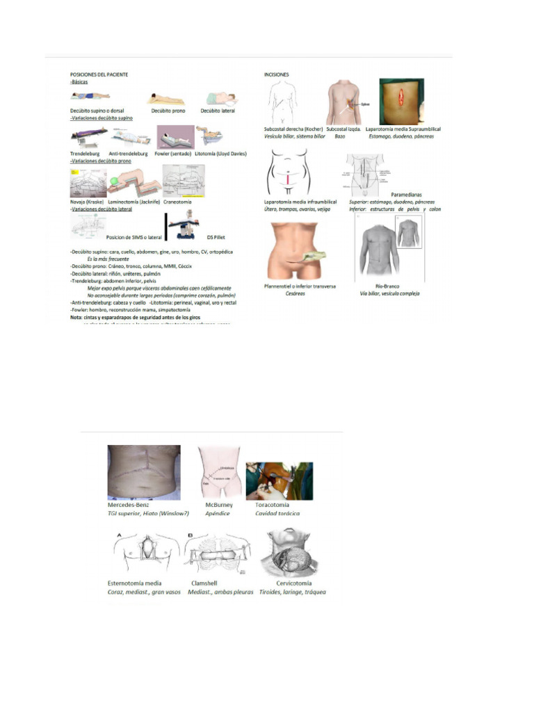 Posiciones e Incisiones QX | PDF
