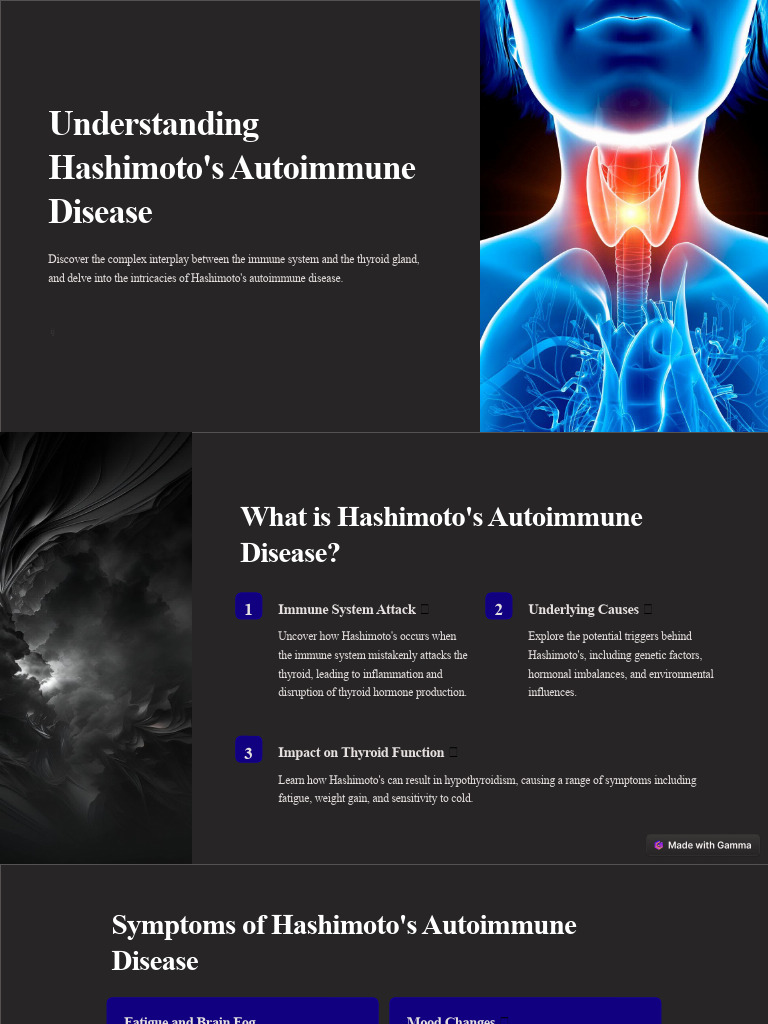 Hashimoto | PDF | Autoimmune Disease | Thyroid
