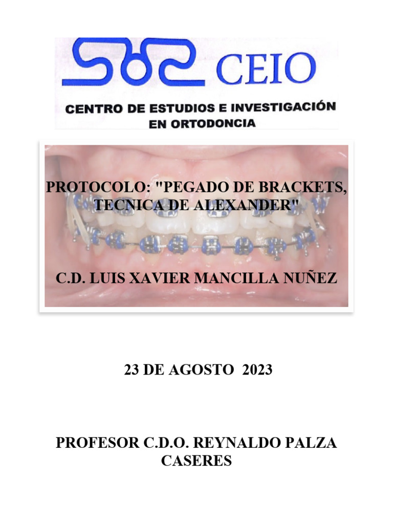 Practica 1 Pegado de Brackets Tecnica de Alexander | PDF | Anatomia ...