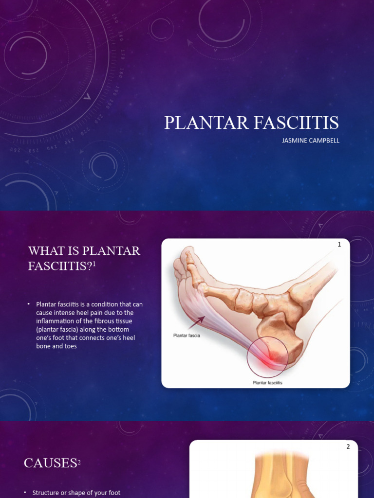 Plantar Fasciitis | Download Free PDF | Foot | Musculoskeletal System