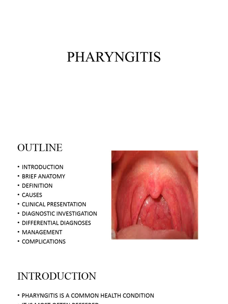 PHARYNGITIs Presentation | PDF | Human Head And Neck | Otorhinolaryngology