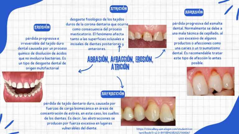 Abrasion, Afraccion, Erosión, Atrición | PDF
