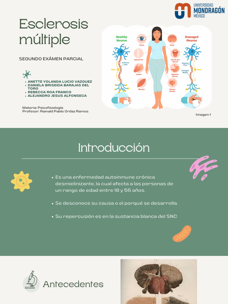 Esclerosis múltiple | PDF | Esclerosis múltiple | Enfermedades y trastornos humanos
