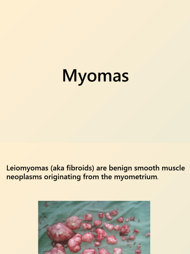 Uterine Myomas | PDF | Necrosis | Neoplasms