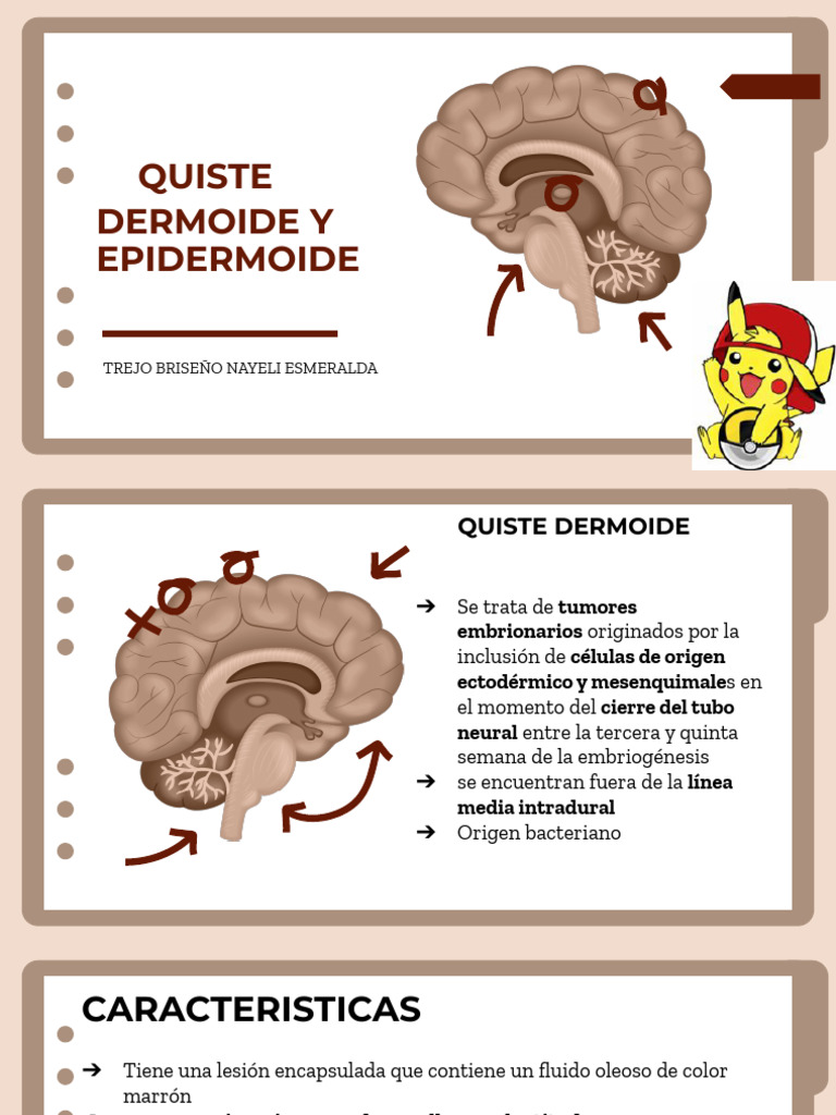 Quiste Dermoide y Epidermoide | PDF | Epidermis | Meningitis