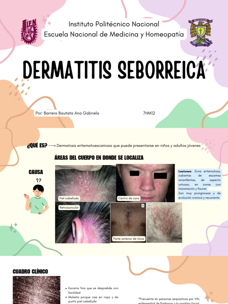 Dermatitis seborreica | PDF | Causas de la muerte | Piel