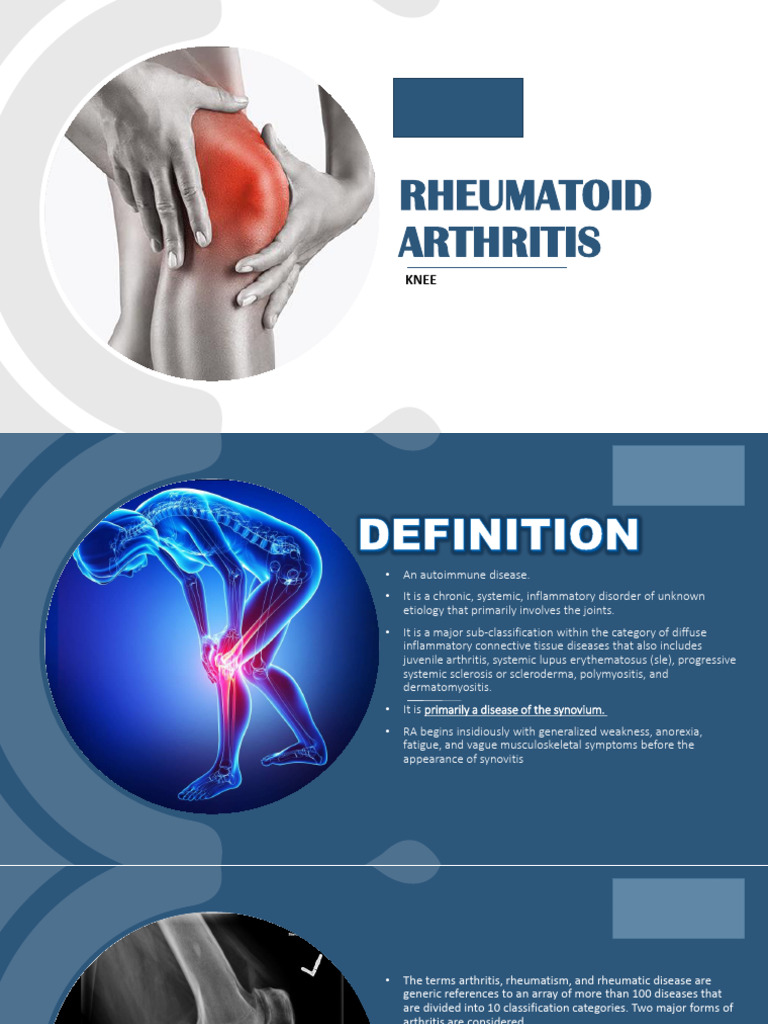GR2 Rheumatoid Arthritis Med Back - 230821 - 164847 | PDF | Knee ...