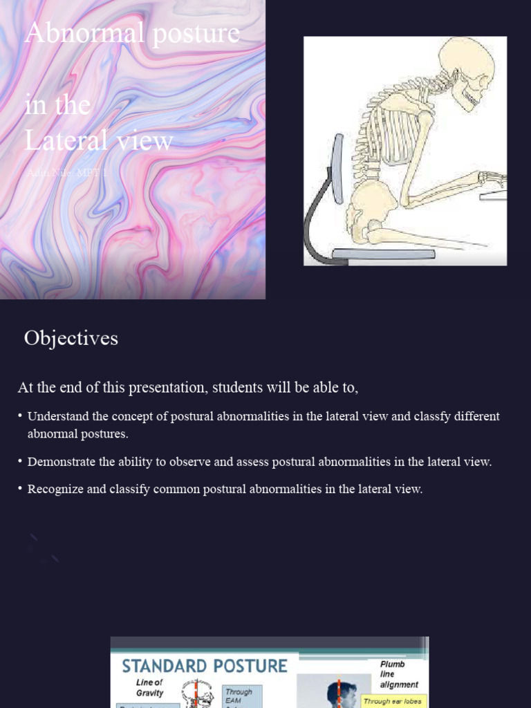 Abnormal Posture | PDF | Self-Improvement | Wellness