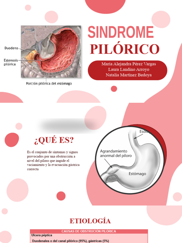 Síndrome Pilórico: Causas y Síntomas | PDF | Medicina | Gastroenterología