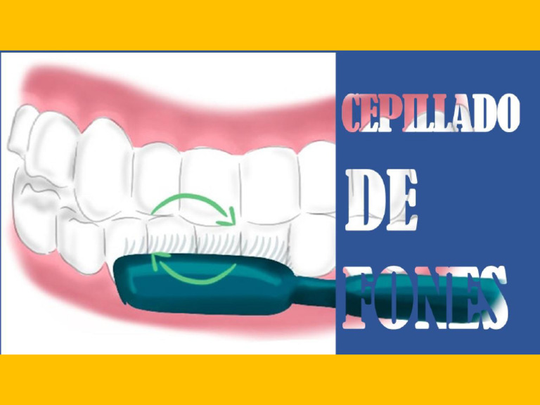 Tecnica de Fones | PDF