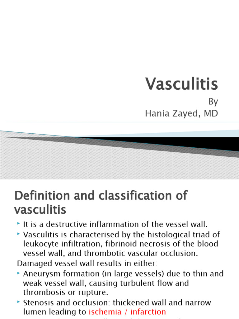 Vasculitis For 5th Year Students Pdf Causes Of Death Immunology
