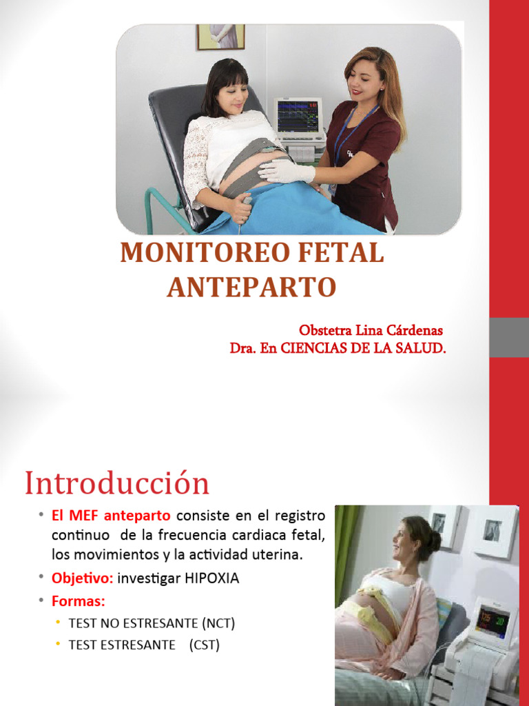 Monitoreo Fetal Anteparto: NCT y CST | PDF