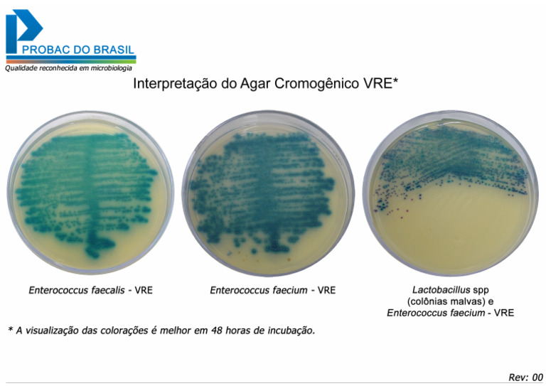 Agar VRE Interpretacion | PDF