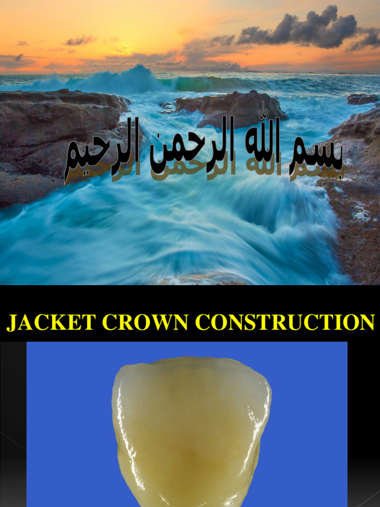 Types and Construction of Porcelain Crowns | PDF | Porcelain ...