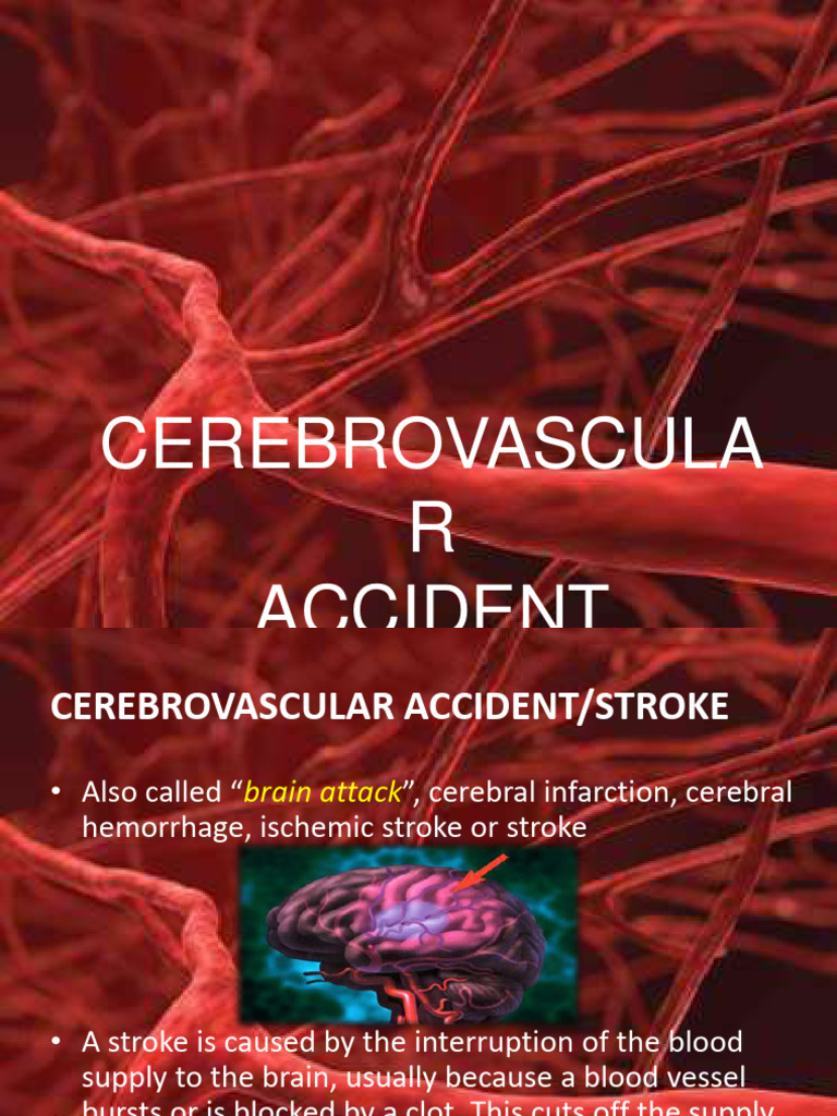 CVA Stroke - Merged | PDF | Stroke | Ischemia