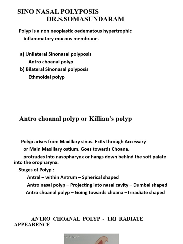 Sino Nasal Polyposis Ss | PDF | Human Head And Neck | Otorhinolaryngology