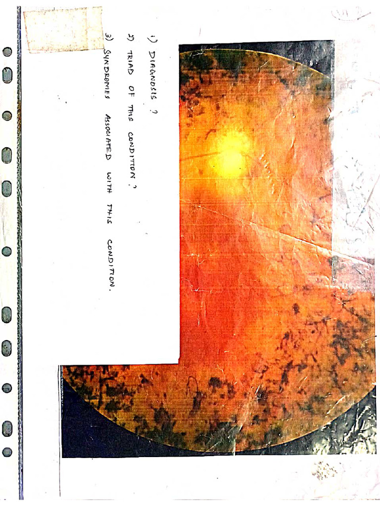 Ophthal Charts | PDF