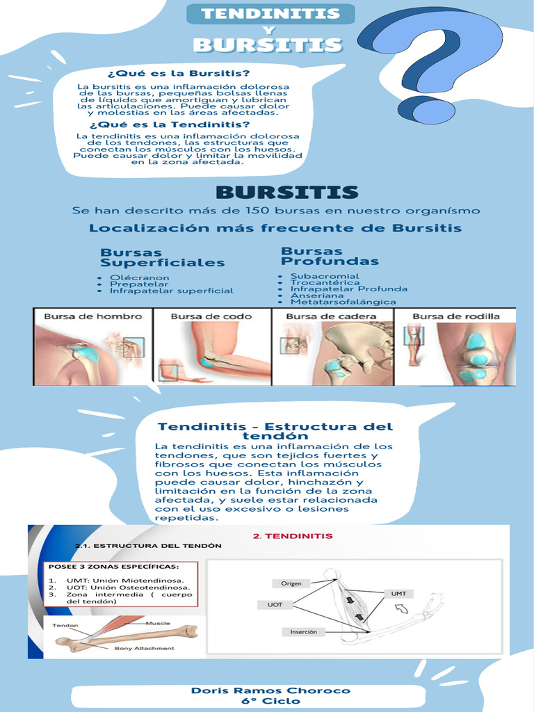 Infografía - Bursitis y Tendinitis | PDF