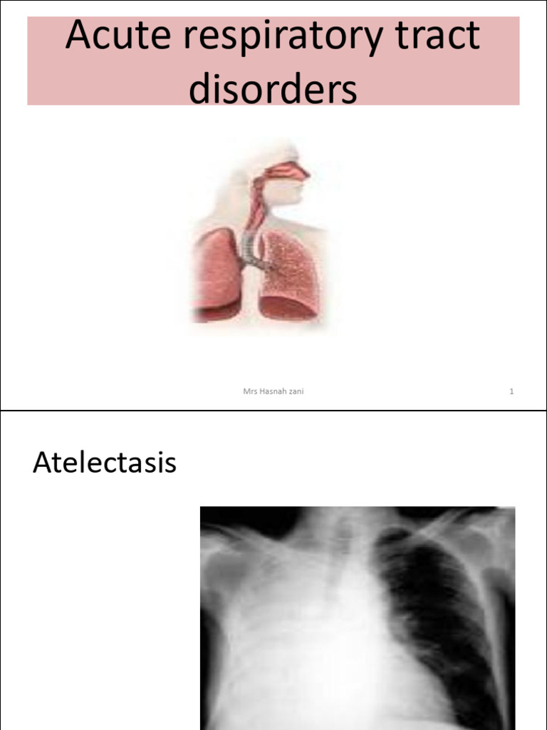 14 Atelectasis | PDF | Respiratory Tract | Causes Of Death