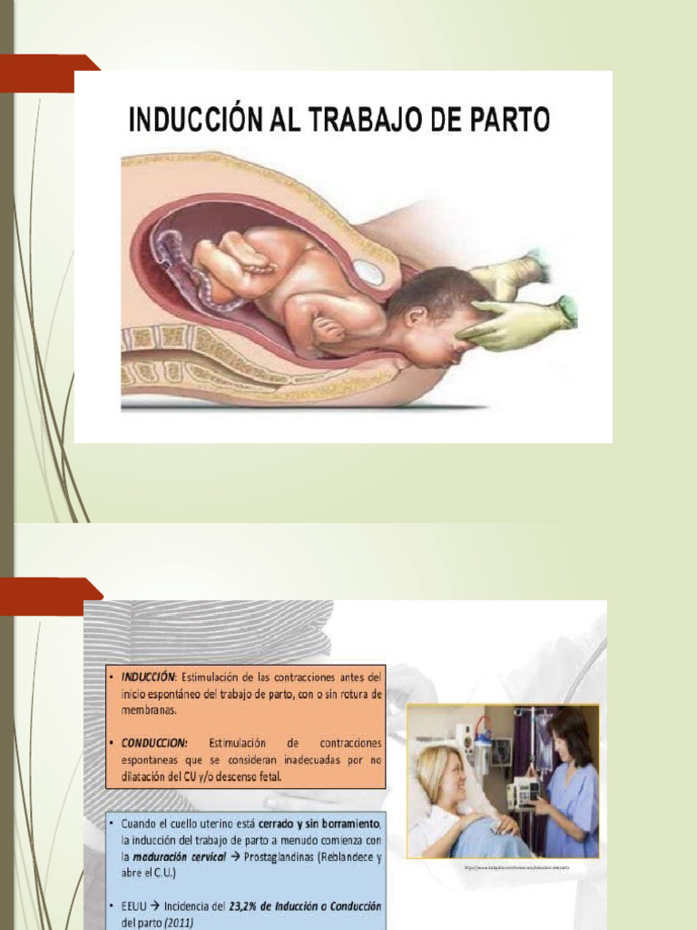 Inducción y Conduccion de La Labor | PDF | Parto | Medicina CLINICA