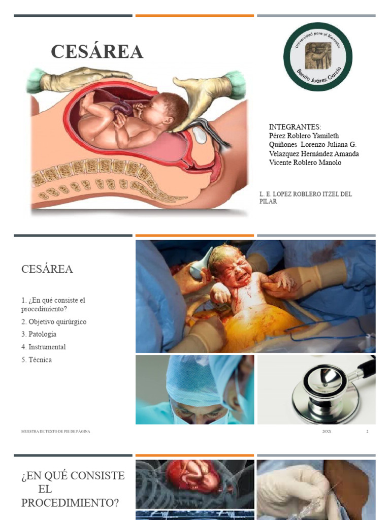 Parto Cesarea Diapositivas | PDF | Ciencia y matemáticas