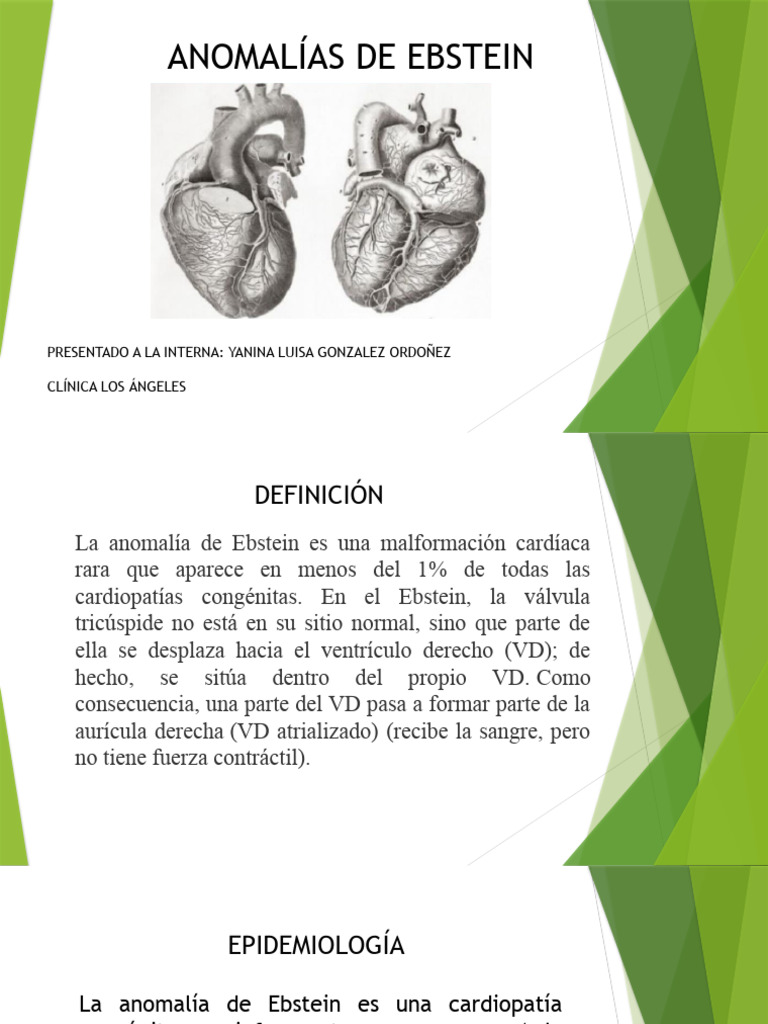 Anomalía de Ebstein: Diagnóstico y Tratamiento | PDF ...