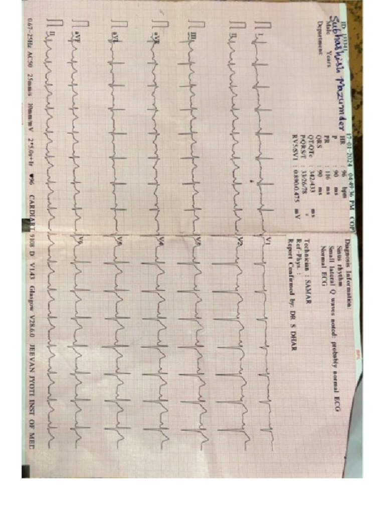 ECG report | PDF