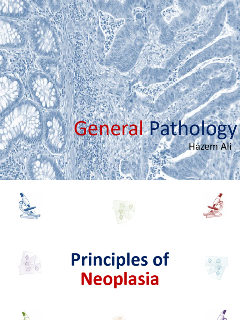 Principles of Neoplasia (New) | PDF | Adenoma | Apoptosis
