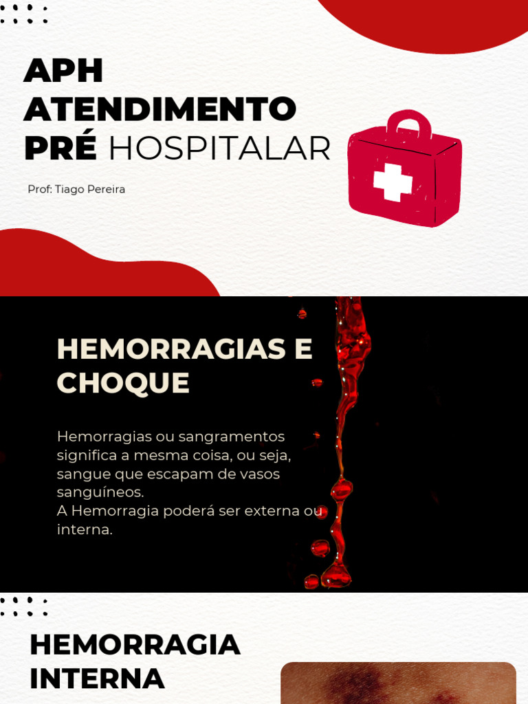 Aula - Hemorragias - 20240219 - 163241 - 0000 | PDF | Estilo de vida