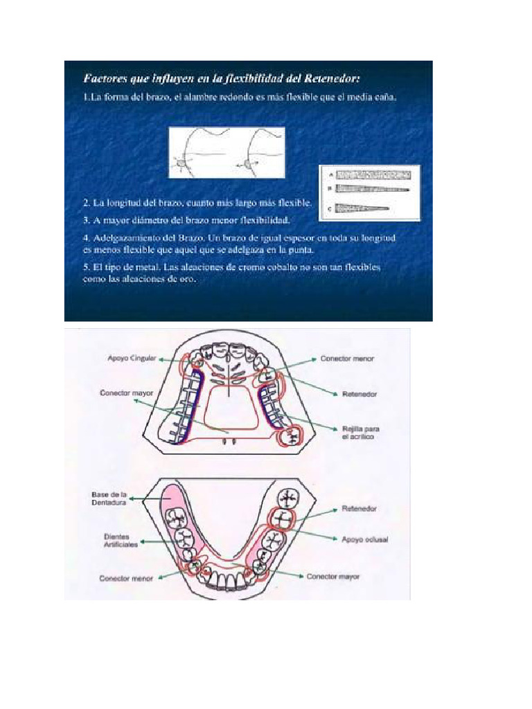 Partes de Una PPR | PDF Partes de Una PPR | PDF