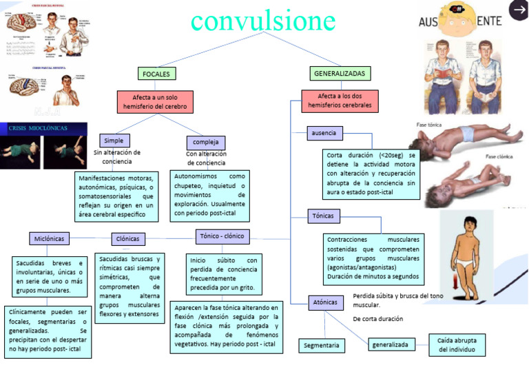Tipos de Convulsiones: Focales y Generalizadas | PDF | Cerebro ...