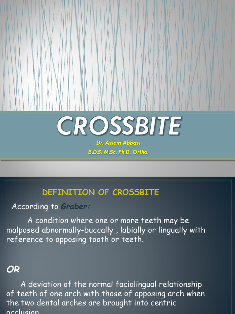 Cross Bite | PDF | Dental Anatomy | Tooth