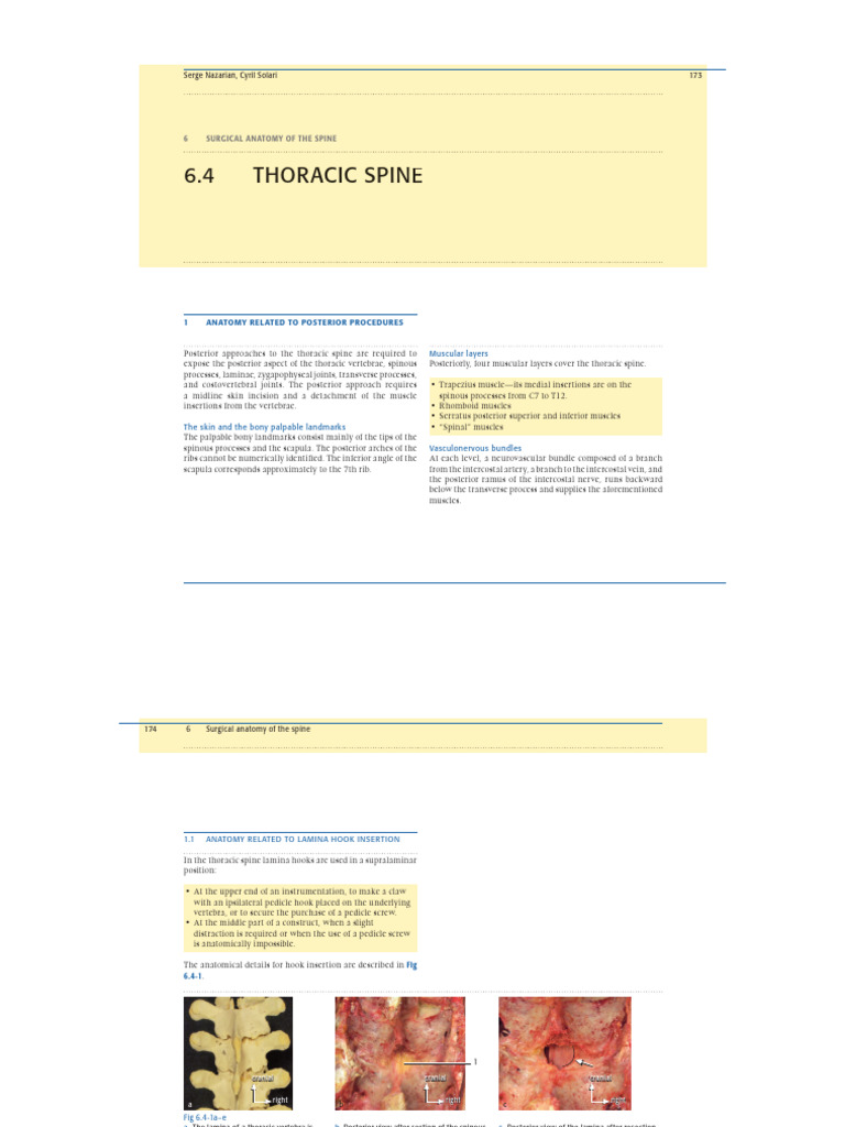 AOSpine Manual Thoracic Spine Anatomy | PDF | Vertebra | Aorta