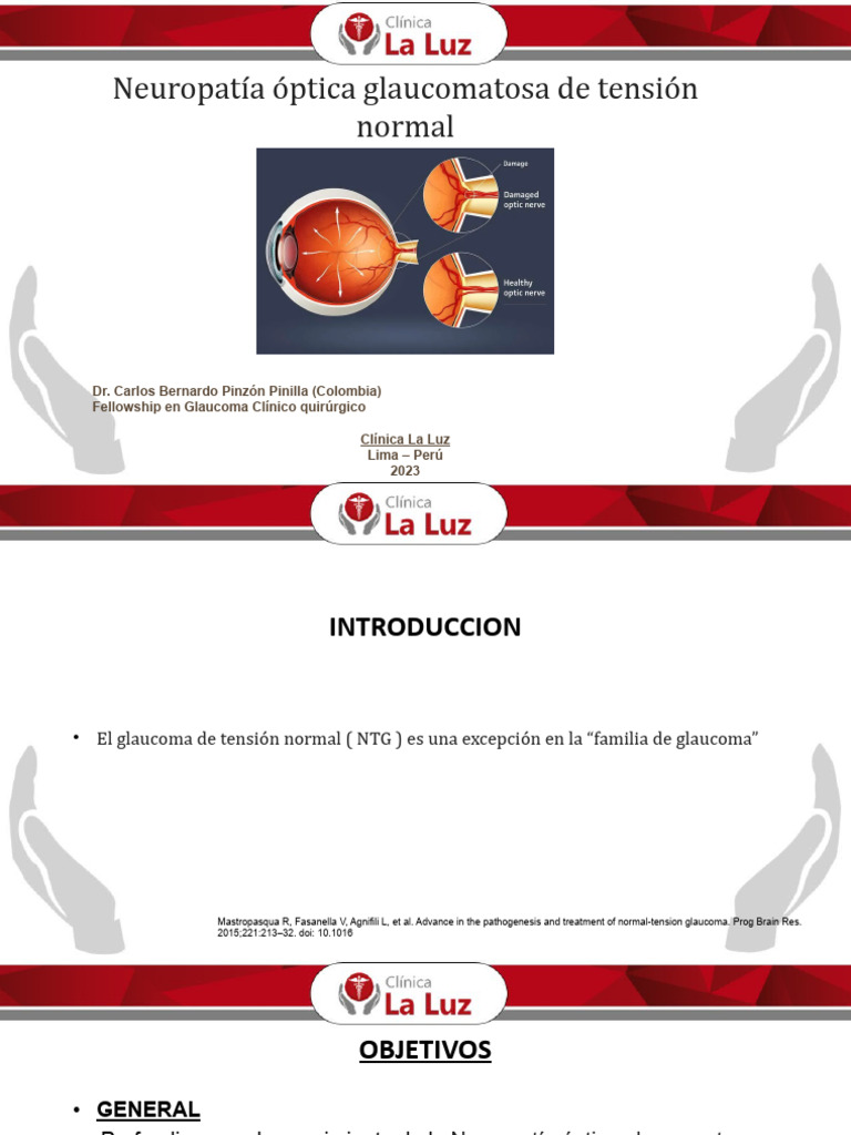 Glaucoma de Tension Normal | PDF | Glaucoma | Oftalmología