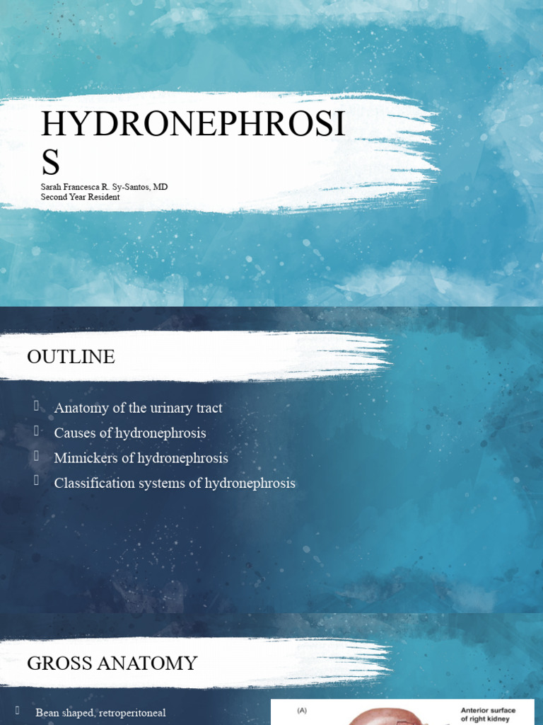 Hydronephrosis | PDF
