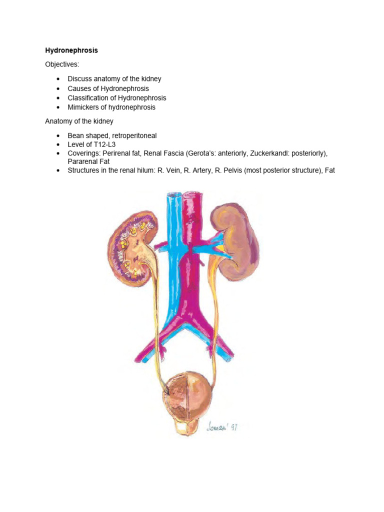 Hydronephrosis Outline | PDF | Kidney | Organ (Anatomy)