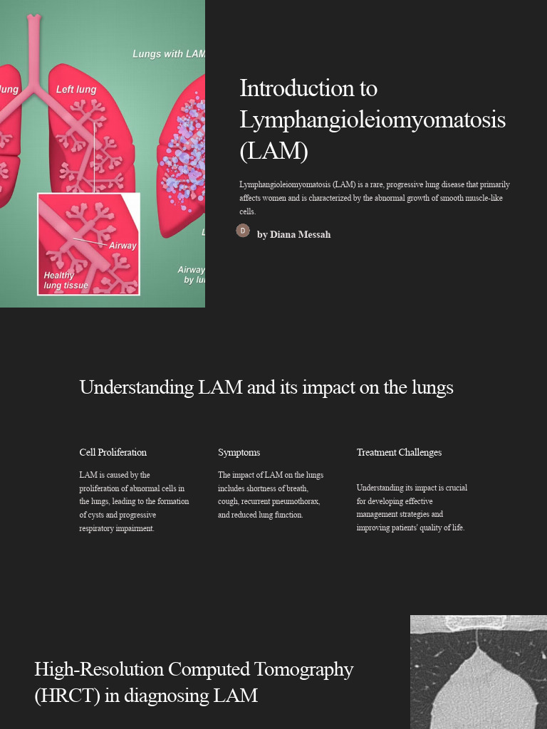 HRCT in LAM Diagnosis and Management | PDF | Respiratory Diseases ...