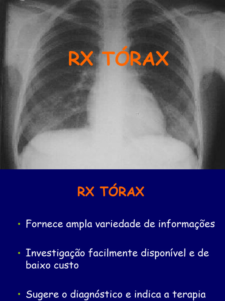 RX Torax | PDF | Especialidades médicas | Medicina Clínica