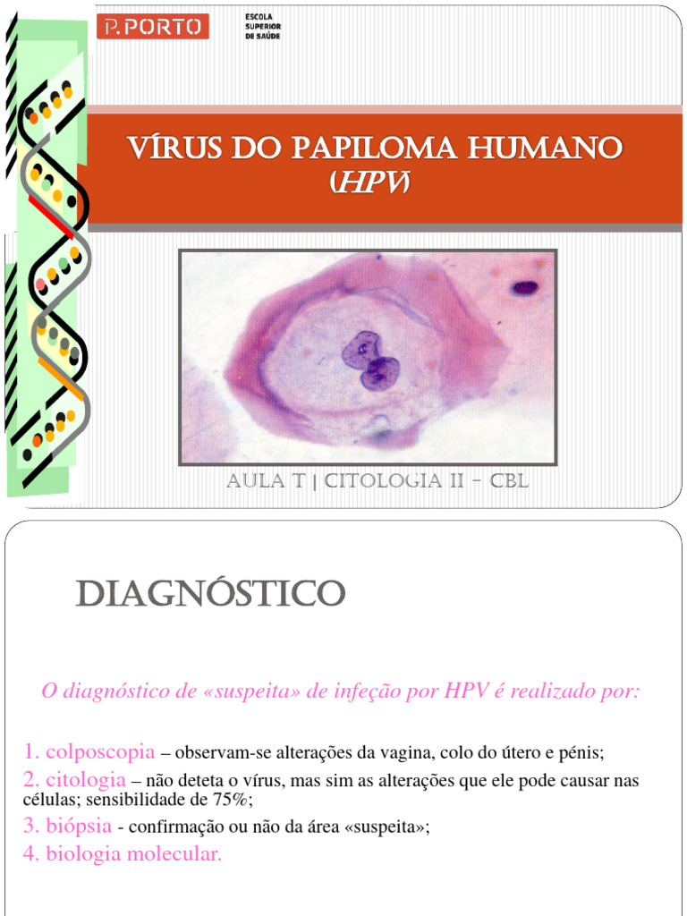 Aula 8 - Diagnóstico de Lesões Intraepiteliais LSIL e HSIL | PDF | Núcleo celular | Citoplasma