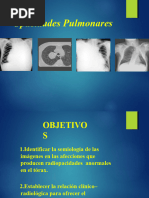 Compresion Radicular. | PDF | La columna vertebral | Sistema ...