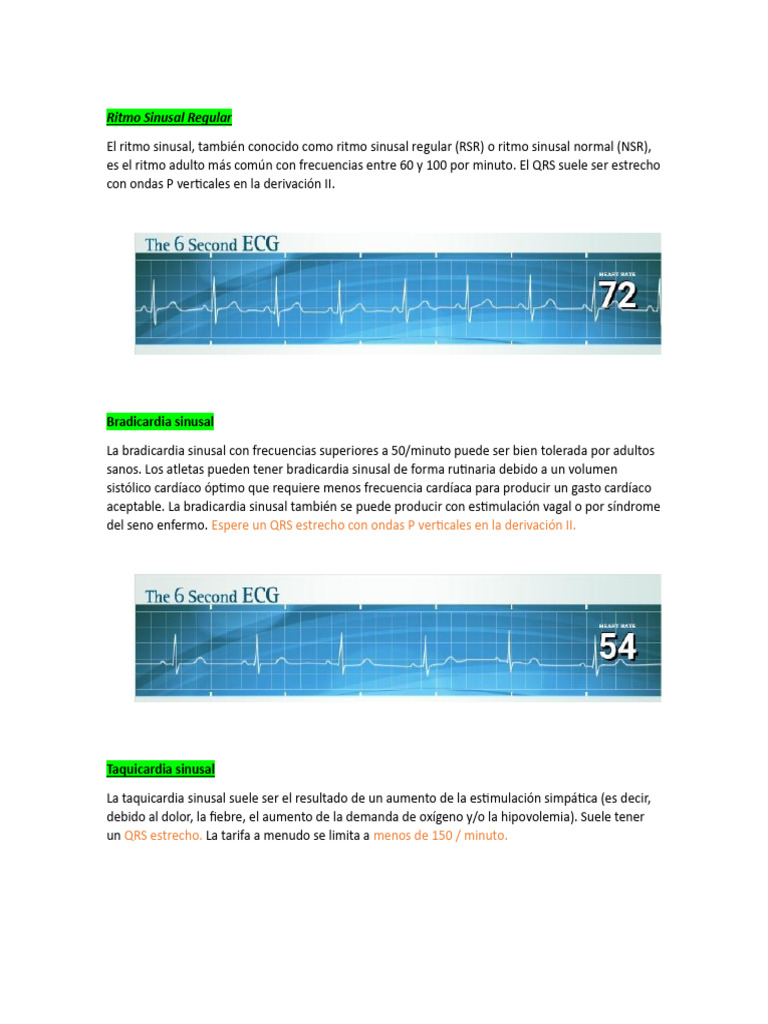 Ritmo Sinusal Regular | PDF | Electrocardiografia | Corazón