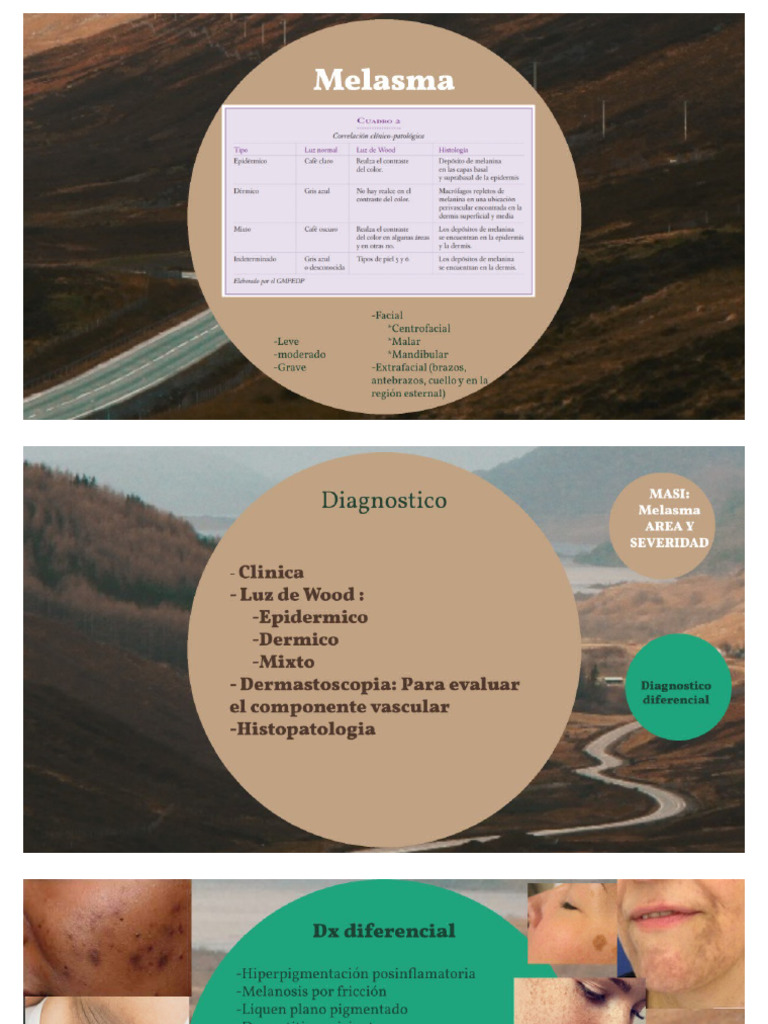 Protocolo Melasma | PDF