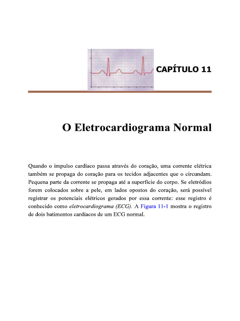 Eletrocardiograma Normal - Guyton | PDF
