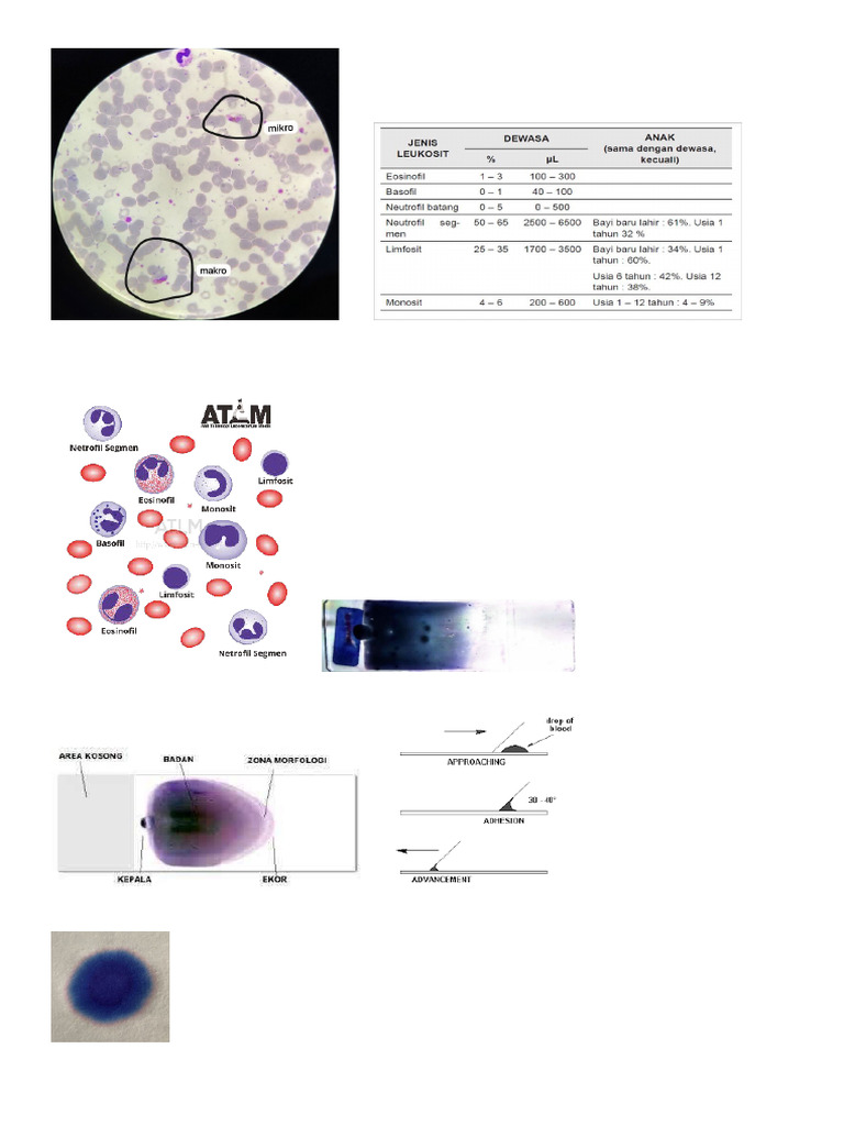 Diffcount & Plasmodium Falciparum | PDF