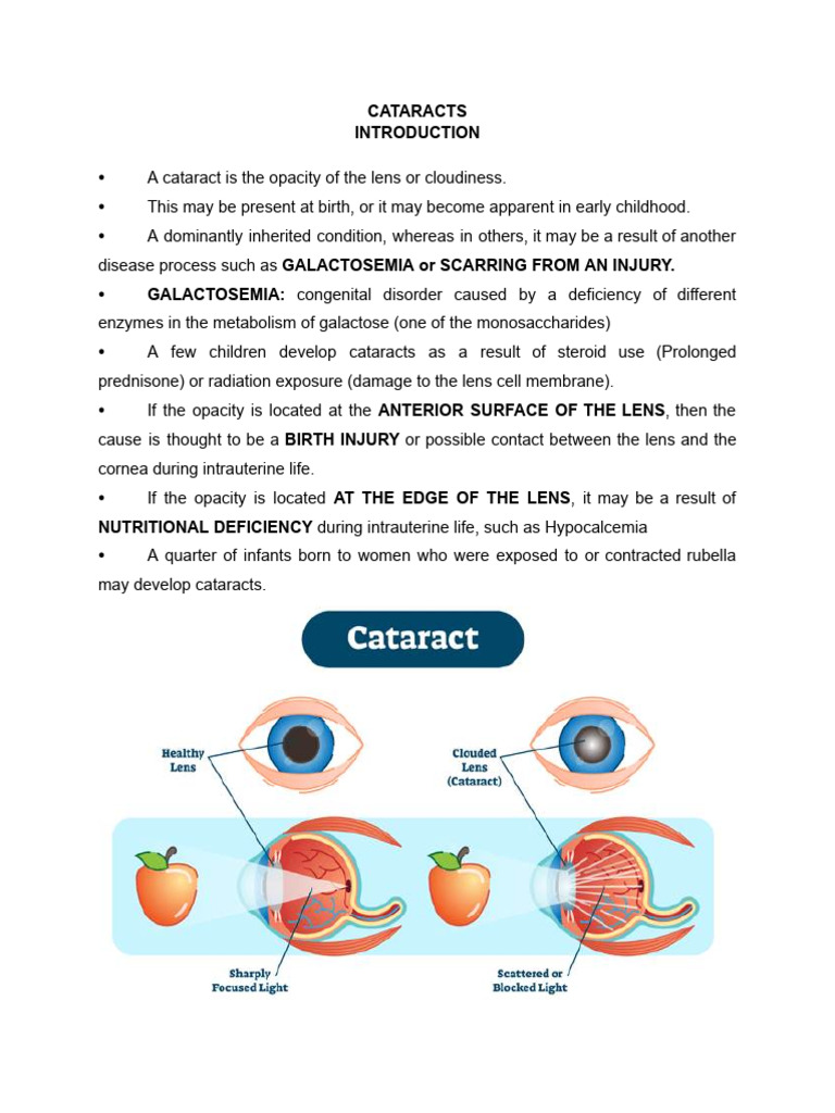 CATARACTS | Download Free PDF | Cataract | Human Eye