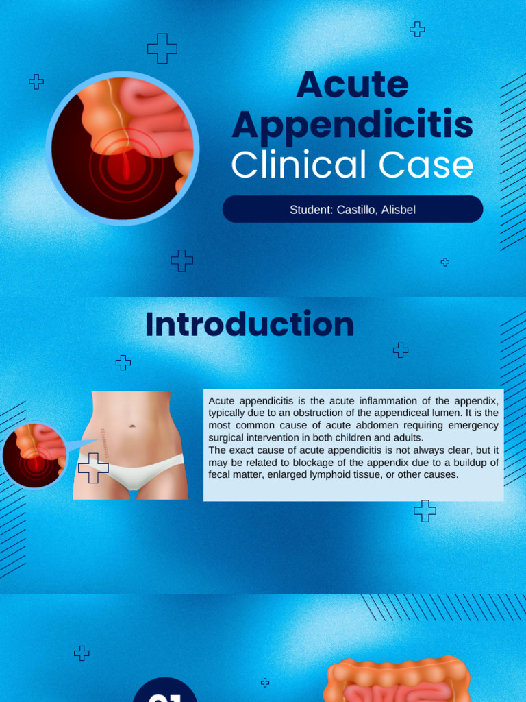 Acute Appendicitis Clinical Case by Slidesgo | PDF | Symptoms And Signs | Clinical Medicine