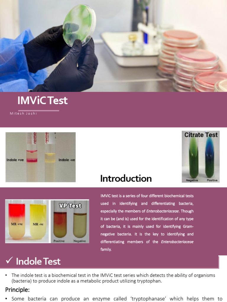 Imvic test LAB (1) | PDF